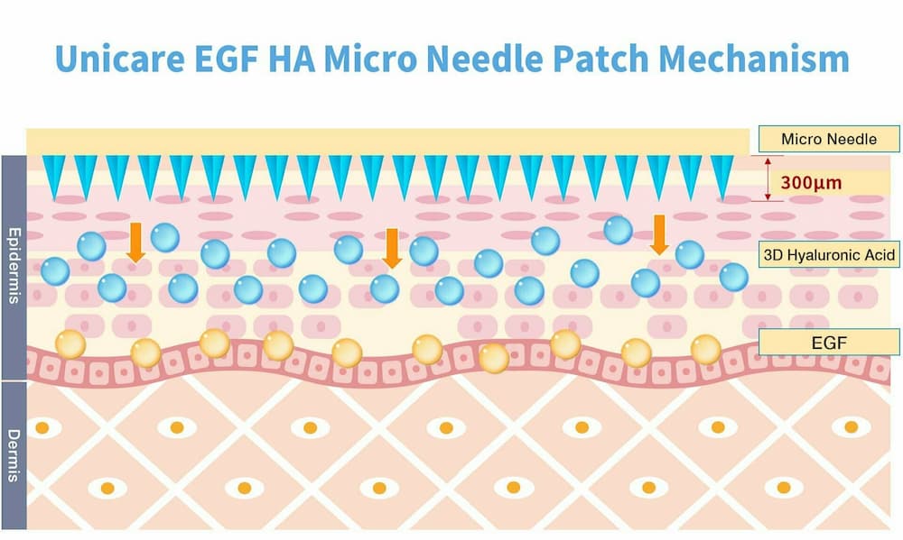The Must-Know Anti-Aging Method - EGF Hyaluronic Acid Microneedle Patch ...