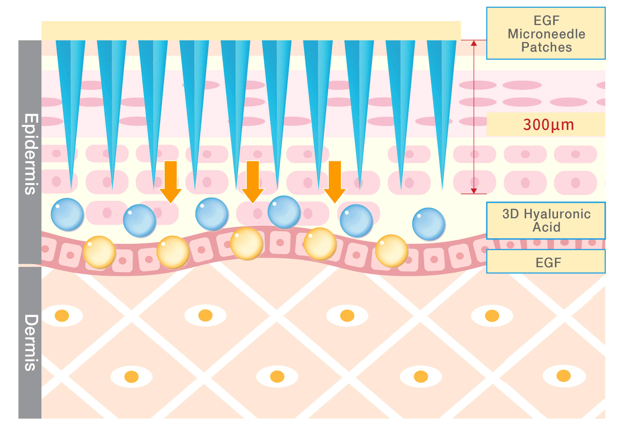 EGF Microneedle Patches - UNICARE Biotech
